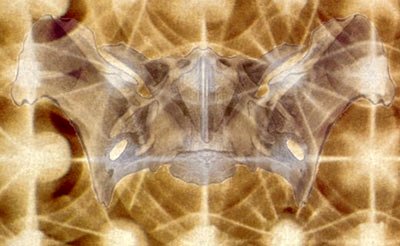 From Orbs to the Sphenoid